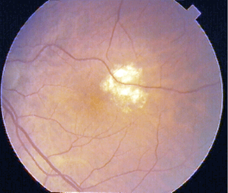 Learning to Live with Low Vision: One Man's Journey Through ...