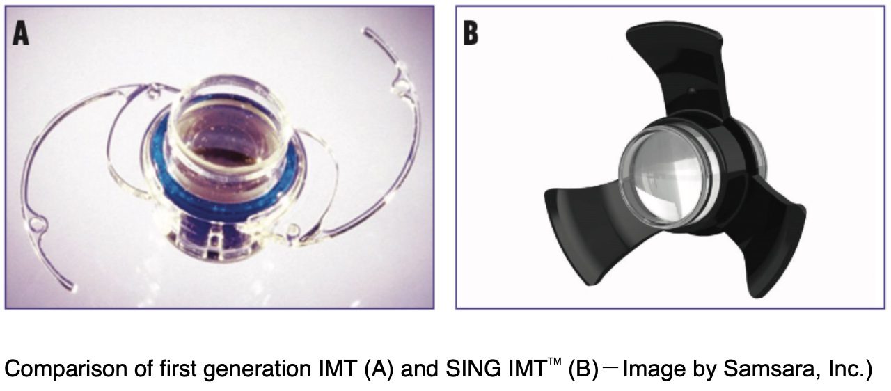 Samsara Vision Announces Clinical Trial for New Investigational ...